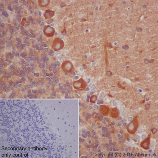 DRP1抗体[EPR19274] (ab184247)| Abcam中文官网
