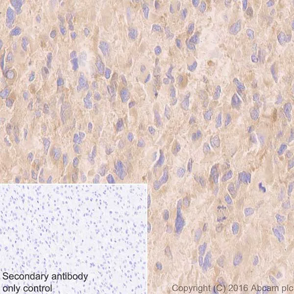 Anti-DRP1 antibody [EPR19275] (ab184248) | Abcam