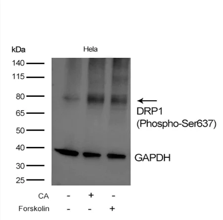 DRP1(磷酸化S637)抗体 (ab193216)| Abcam中文官网