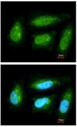 Anti-DUSP10 antibody (ab228987) | Abcam