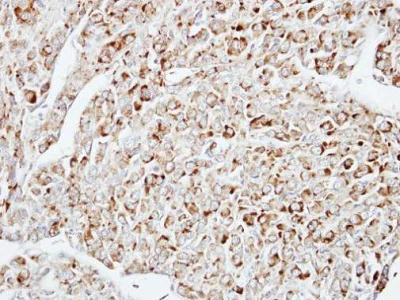 Anti-DUSP10 antibody (ab228987) | Abcam