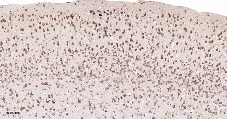 Anti-DUSP6 antibody [9C3] (ab326708) | Abcam中文官网