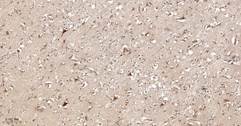 Anti-DUSP6 antibody [9C3] (ab326708) | Abcam中文官网