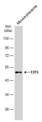 Anti-E2F5 antibody (ab227587) | Abcam
