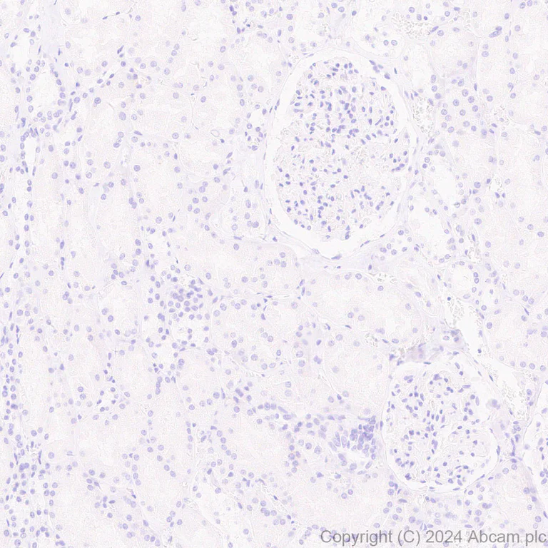 EBV Nuclear Antigen/EBNA1抗体[EPR28706-78] (ab316860)| Abcam中文官网