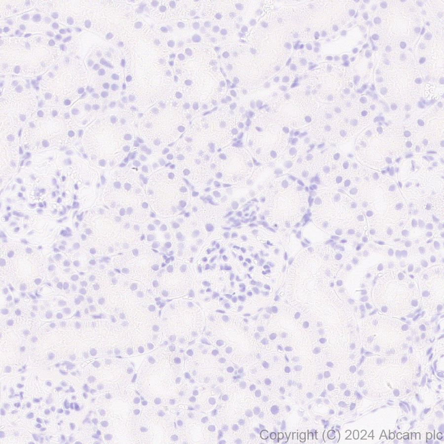 Anti-EBV Nuclear Antigen/EBNA1 antibody [EPR28706-78] - BSA and Azide ...