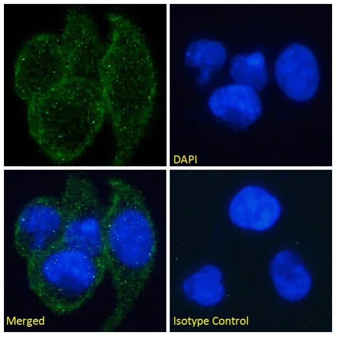 Anti-EDAR antibody [EDAR12] (ab245684) | Abcam