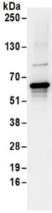 Anti-EDC3 antibody (ab168851) | Abcam