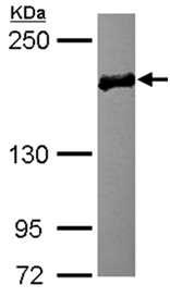 Anti-EDC4 antibody (ab154026) | Abcam
