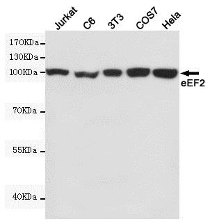 Anti-EEF2/Elongation factor 2 antibody [4B3-G7-H5] (ab131202) | Abcam