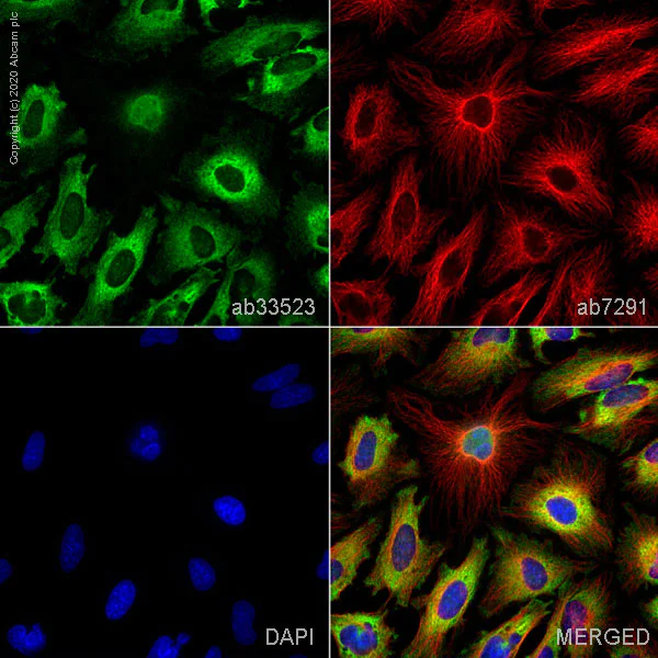 Anti-EEF2/Elongation factor 2 antibody (ab33523) | Abcam