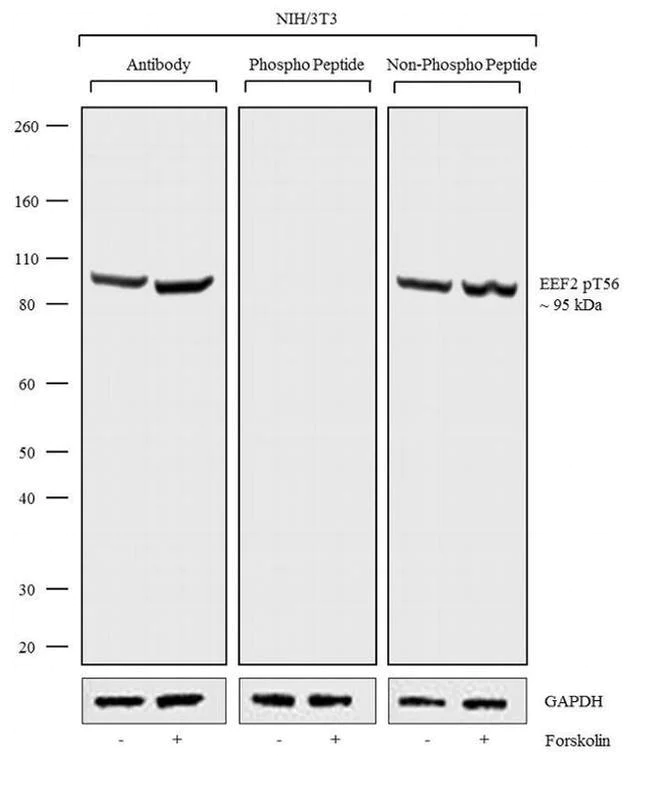 Anti-EEF2/Elongation factor 2 (phospho T56) antibody [RP23040245 ...