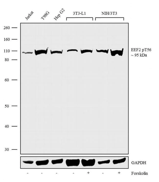 Anti-EEF2/Elongation factor 2 (phospho T56) antibody [RP23040245 ...