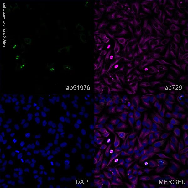 Eg5抗体[mAbcam 51976] (ab51976)| Abcam中文官网