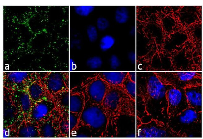 Anti-EGFR (phospho Y1148) antibody [RP23040050] (ab307989) | Abcam