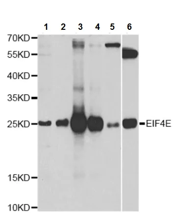Anti-eIF4E antibody (ab238519) | Abcam