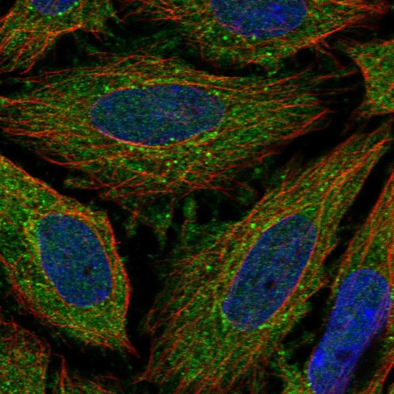 Anti-Elongation of very long chain fatty acids protein 3 antibody ...