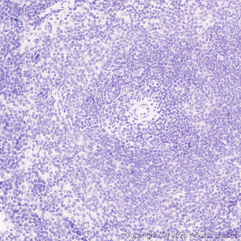 Anti-EN1 / Engrailed 1 antibody [EPR26667-4] (ab325014) | Abcam