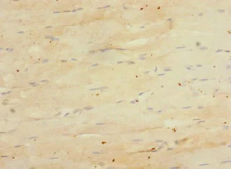 Anti-Endomucin antibody (ab230018) | Abcam