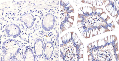 Anti-Endostatin/COL18A1 antibody (ab3453) | Abcam