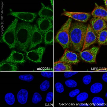 Anti-ENO1 + ENO2 + ENO3 antibody [EPR19680] (ab222514) | Abcam
