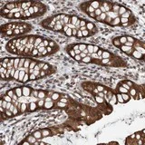 ENY2抗体 (ab121836)| Abcam中文官网