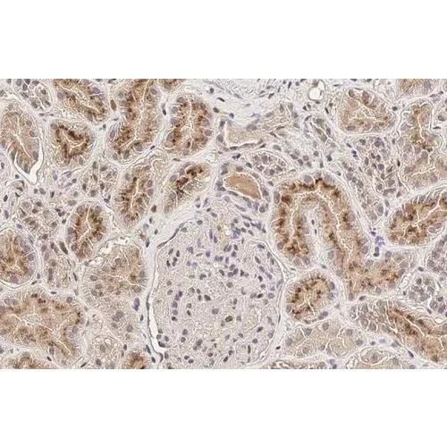 Anti-Eosinophil derived neurotoxin antibody [HL2166] (ab317148) | Abcam中文官网