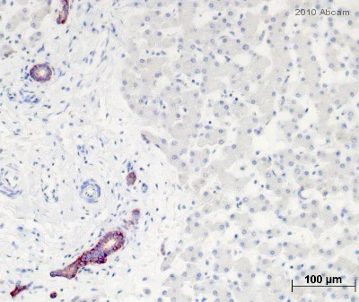 Anti-EpCAM antibody [Ber-EP4] Mouse monoclonal (ab7504) | Abcam