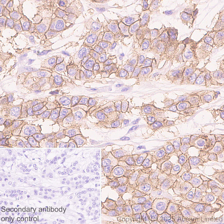 Anti-Eph receptor A2 antibody [EPR29732-509] (ab324955) | Abcam