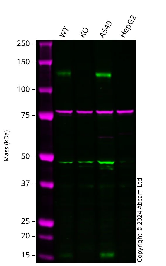 Anti-Eph receptor B2 antibody [EPR22427-268] KO tested (ab252935) | Abcam