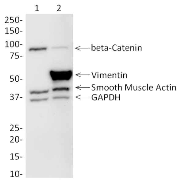 Epithelial-Mesenchymal Transition (Beta Catenin, Vimentin) Western Blot ...