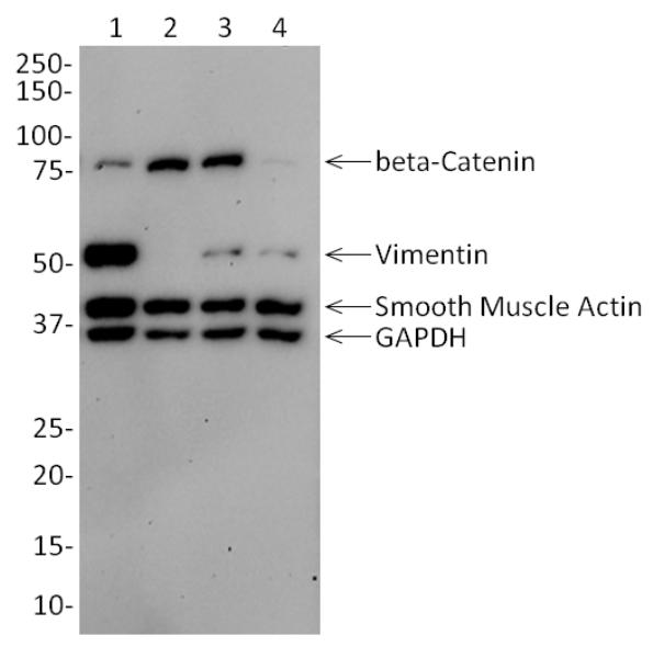 Epithelial-Mesenchymal Transition (Beta Catenin, Vimentin) Western Blot ...