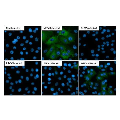 Anti-Equine Encephalitis Virus nsP2 antibody [HL1920] (ab317118) | Abcam