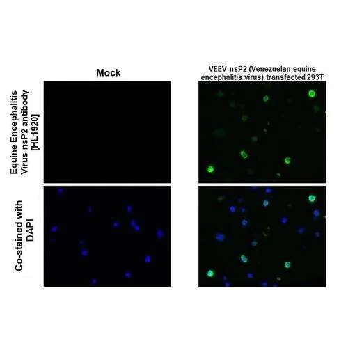 Anti-Equine Encephalitis Virus nsP2 antibody [HL1920] (ab317118 ...