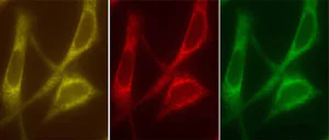 ER Staining Kit - Green Fluorescence - Cytopainter (ab139481) | Abcam