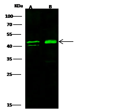 Anti-ERCC8 antibody (ab275596) | Abcam