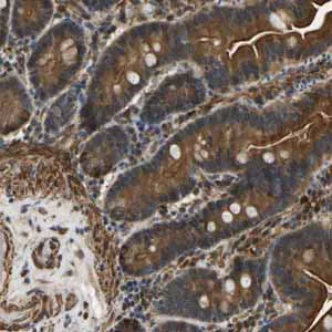 Anti-ERGIC1 antibody (ab121582) | Abcam