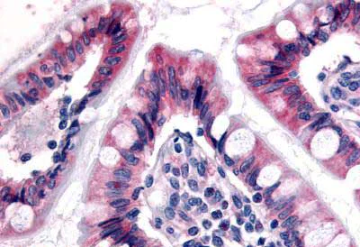 Estrogen Related Receptor gamma抗体- N-terminal (ab150539)| Abcam中文官网