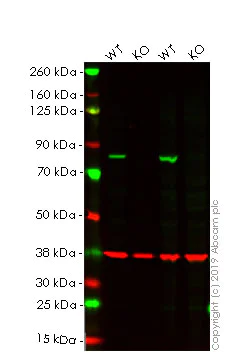 Exosome Panel (Calnexin, CD9, CD63, CD81, Hsp70, TSG101) (ab275018 ...