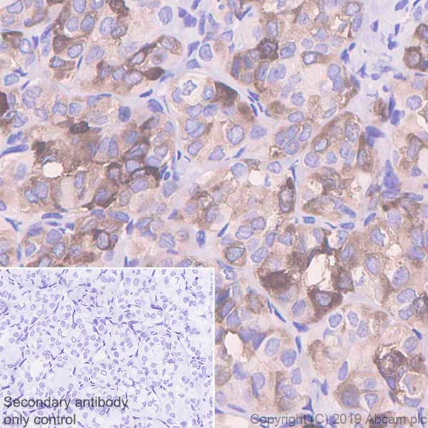 Anti-Extracellular matrix protein 1 antibody [EPR22434-381] (ab253244 ...