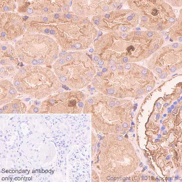 Extracellular matrix protein 1抗体[EPR6701] (ab126629)| Abcam中文官网