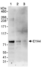 Anti-EYA4 antibody (ab93865) | Abcam