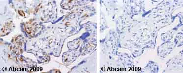 Anti-Ezrin (phospho T567) antibody (ab47293) | Abcam
