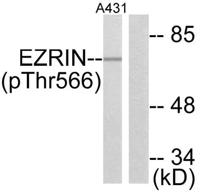 Anti-Ezrin (phospho T567) antibody (ab47293) | Abcam