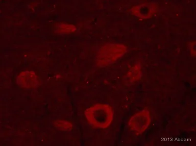 F-actin Staining Kit - Red Fluorescence - Cytopainter (ab112127) | Abcam