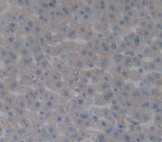 Anti-Factor B antibody (ab231072) | Abcam