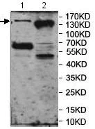 Anti-Factor H antibody (ab170036) | Abcam