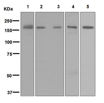 Anti-Factor H antibody [EPR6226] (ab124769) | Abcam