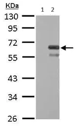 Anti-Factor X antibody (ab97632) | Abcam