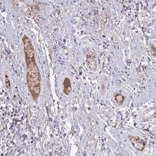 Anti-Factor XIII antibody (ab204054) | Abcam